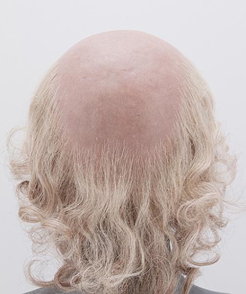 Süddeutsche Haarveredlung - LENGAR Silicone Bald Wig